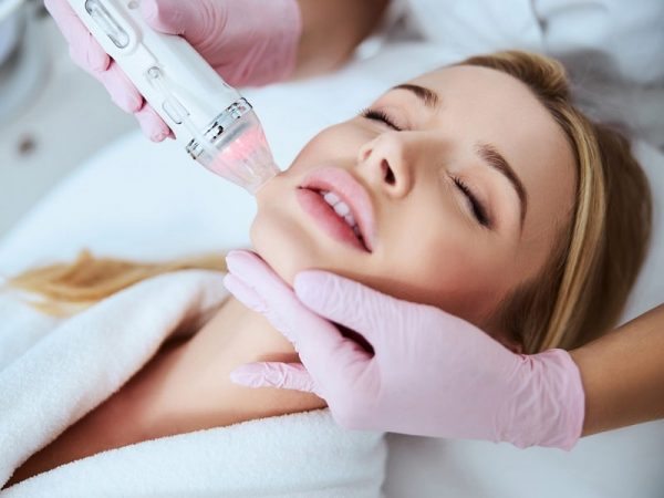 Fractional RF Microneedling - Jhoveth Lee-Overy Aesthetic Clinic ...